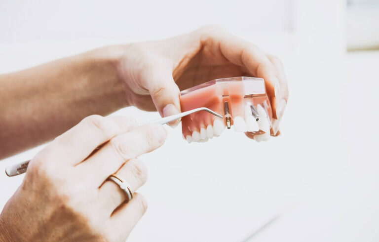 Paradentoza - Uzroci, Simptomi i Liječenje - Dentis.hr